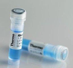 rt-PA - 搜狗百科