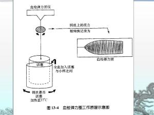 血栓弹力图 - 搜狗百科