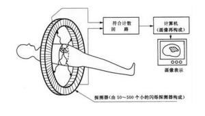 CT 成像原理 - 搜狗百科