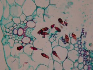 冬孢子 - 搜狗百科